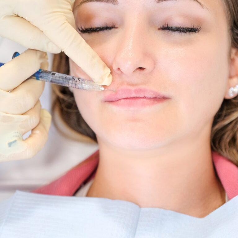 Injections d'acide hyaluronique dans les lèvres à Bordeaux